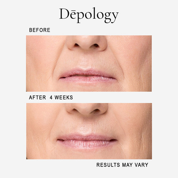 Depology Before And After